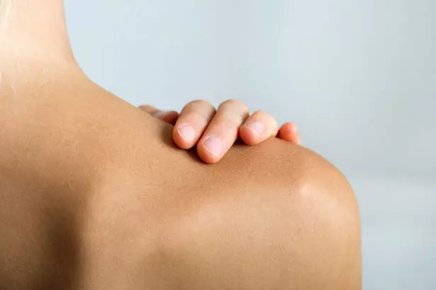 ženský chrbát bez akné